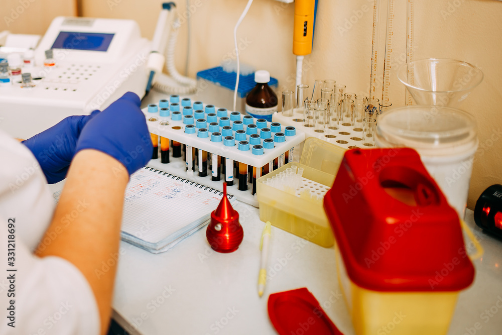 Blood test process in laboratory. Doctor hands making blood test. Many ...