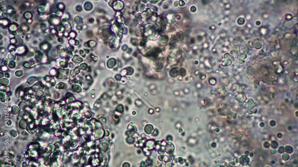 Vidéo Stock Clumps of sourdough round milk bacillus and sticks move ...