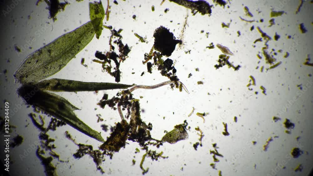 Microcosm in a drop of water, nematode worm and infusoria under ...