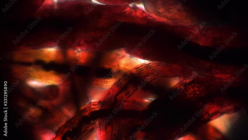 Very mobile transparent red worms in a microscope. The theme of micro ...