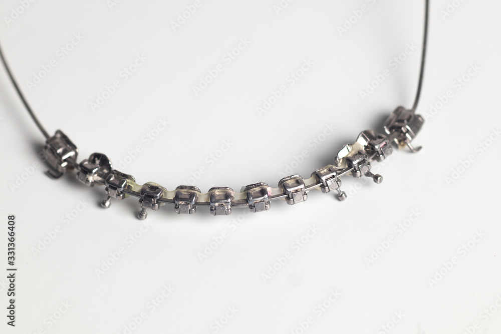 Macro photo of dental braces without teeth, dismounted from mouth ...