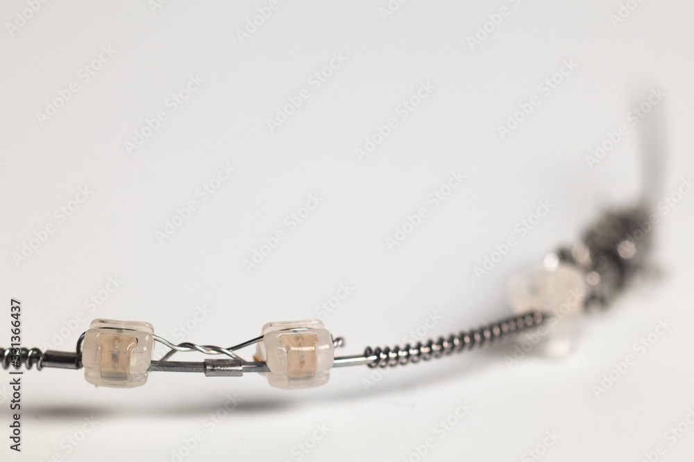 Macro photo of dental braces without teeth, dismounted from mouth ...