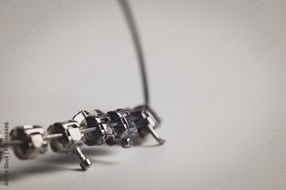 Macro photo of dental braces without teeth, dismounted from mouth ...