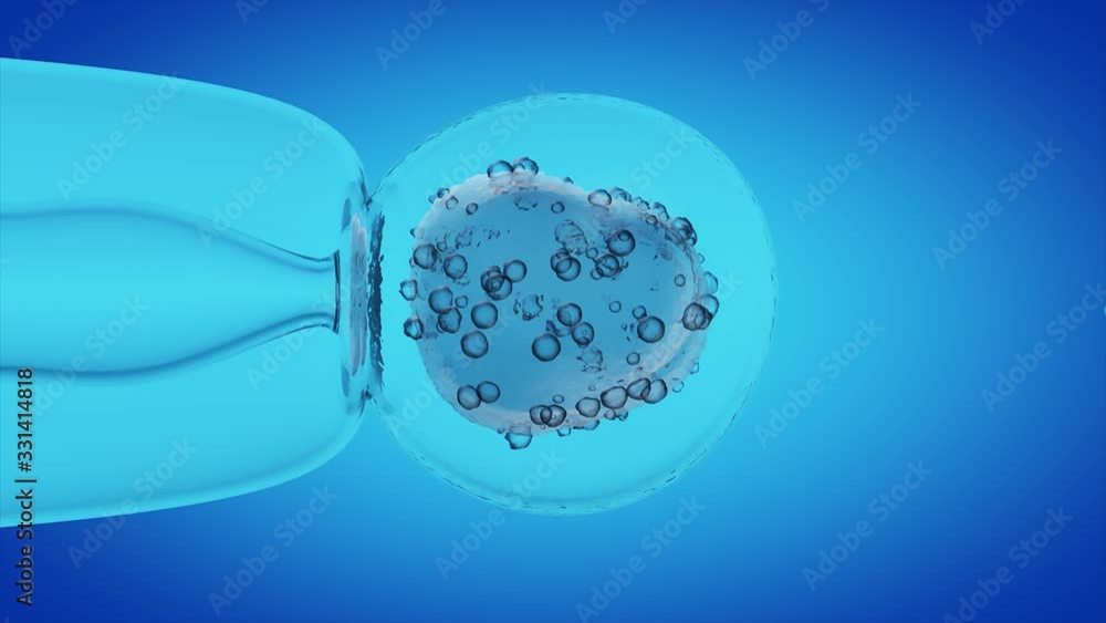 A female egg under a powerful microscope is fertilized by a sperm cell ...