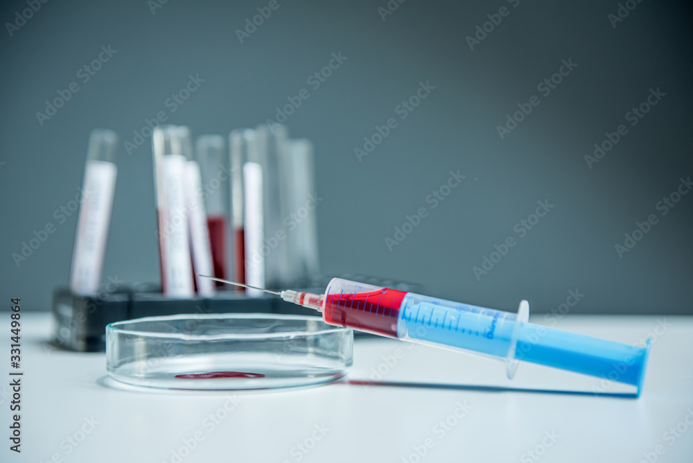 Coronavirus covid19 infected blood sample in sample tube on table in ...