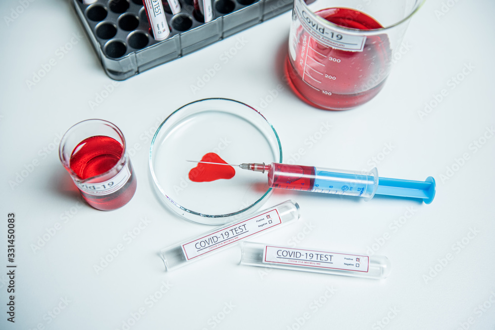 Coronavirus covid19 infected blood sample in sample tube on table in ...