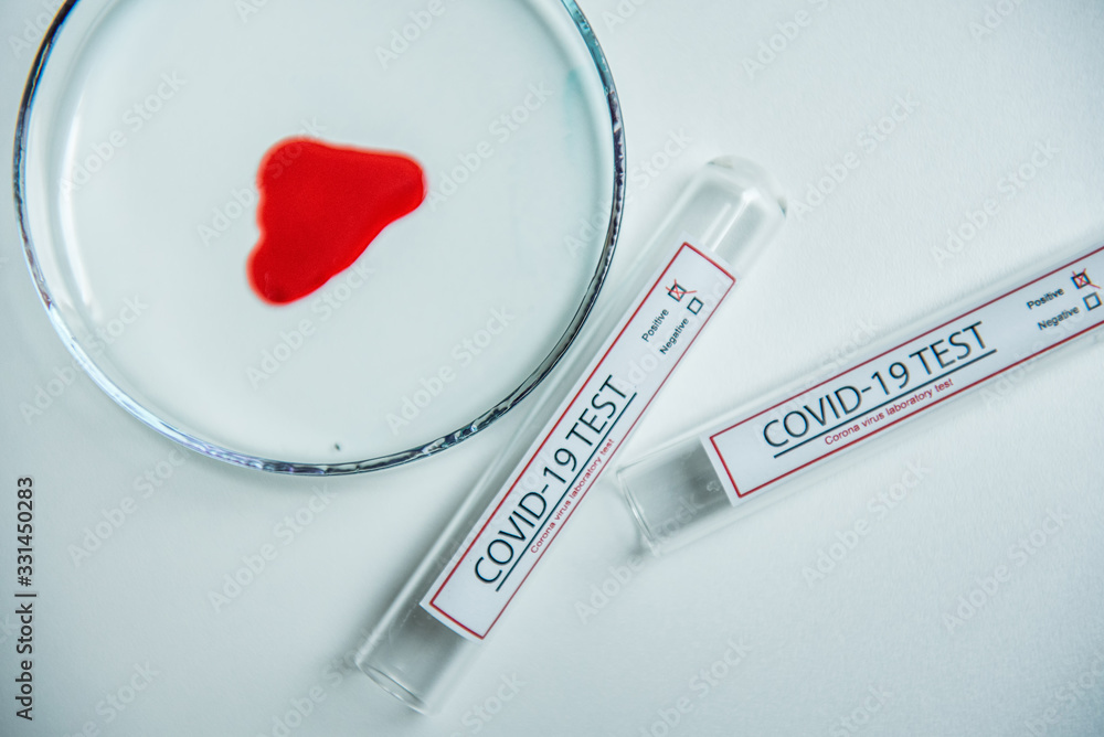 Coronavirus covid19 infected blood sample in sample tube on table in ...