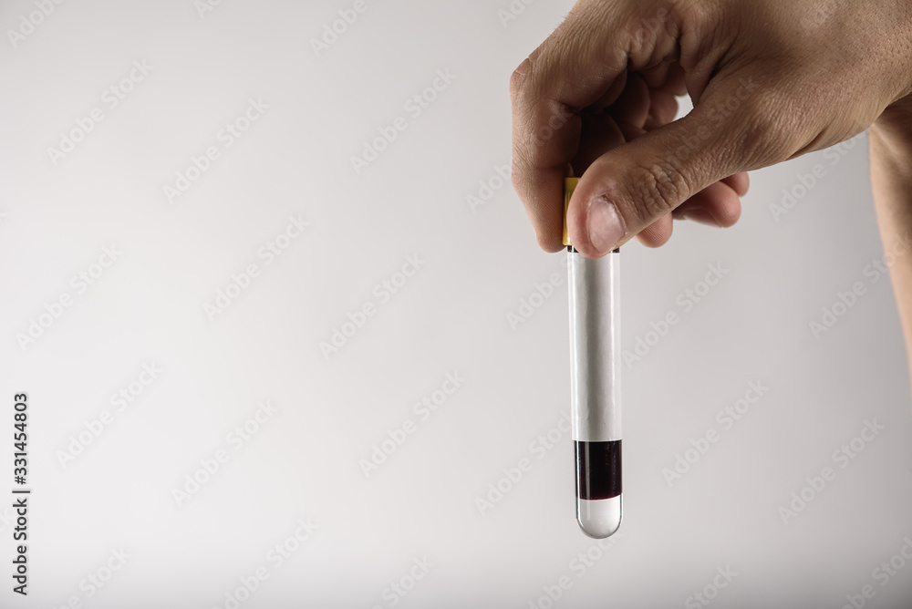 man's hand holding blood in a test tube close up, physical examination ...