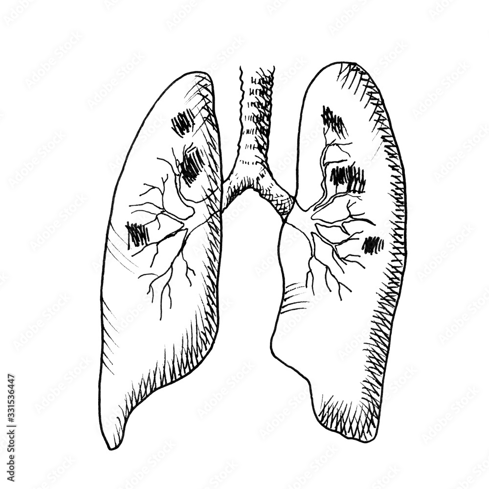 black and white illustration of a lung affected by a disease. Human ...