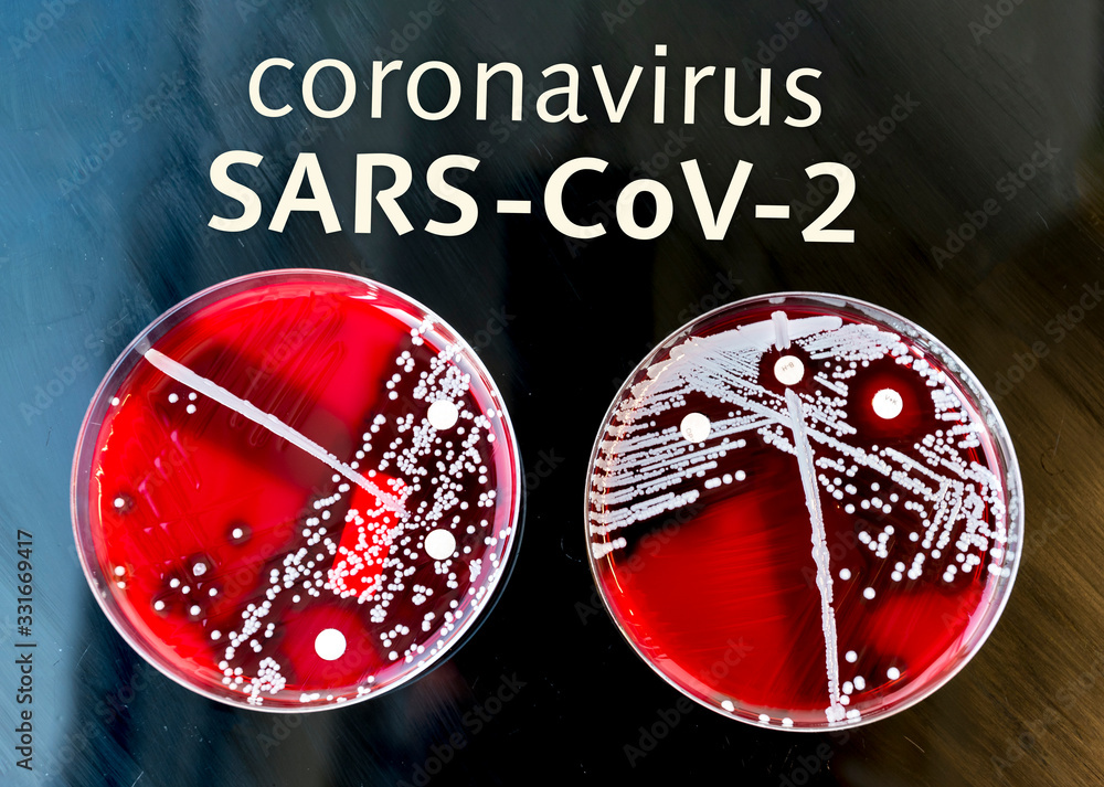 Coronavirus colonies in Petri Dishes, a new virus has been discovered ...