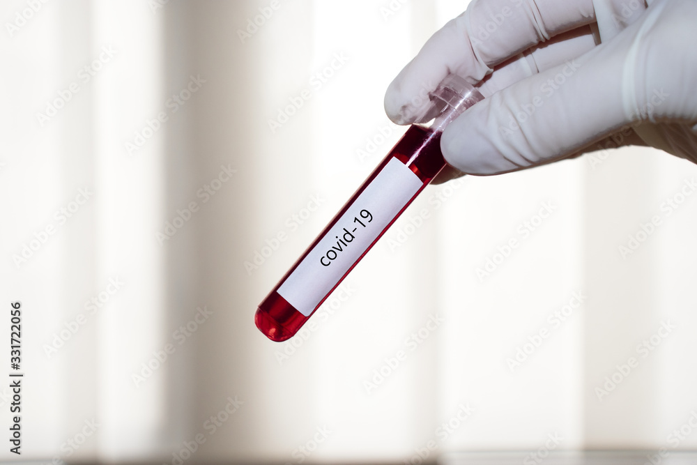 Positive COVID-19 test and laboratory sample of blood testing for ...