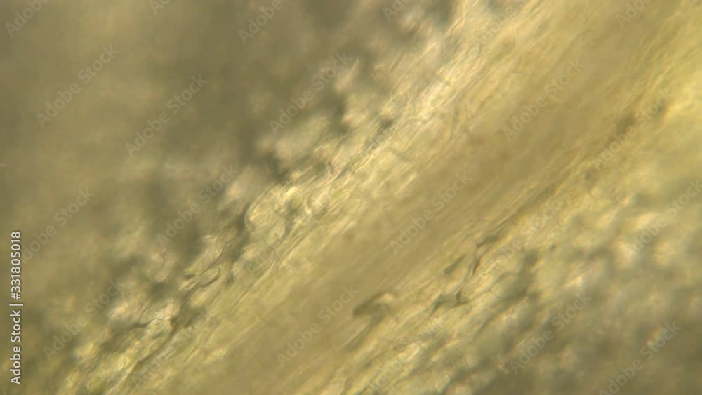 Microscopy of green plant (lettuce). Magnification 300x with visible ...