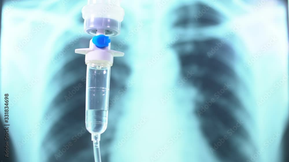 Saline drip medical,IV Drip Solution, Intravenous Treatment for ...