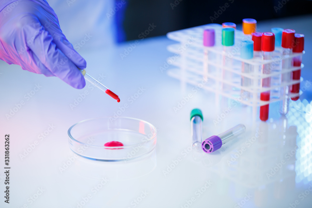 A medical professional, laboratory assistant, doctor performs an ...