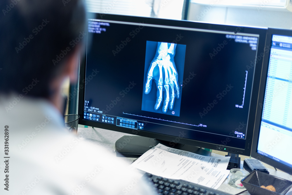 Radiographie de la main médecin radiologue diagnostic examen imagerie ...