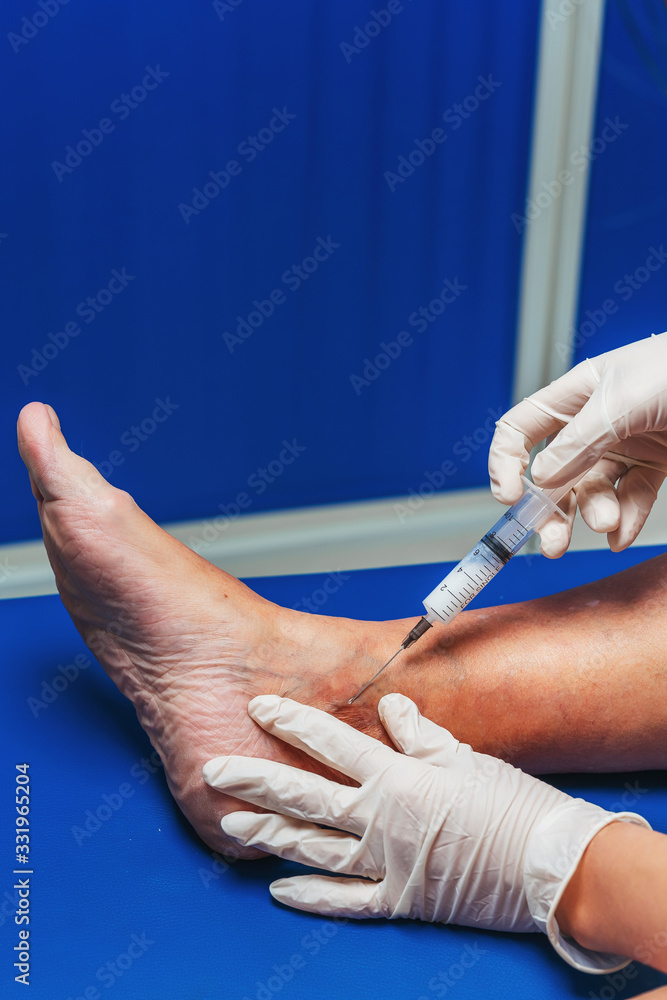 Injections into the veins of an elderly woman's leg close-up. Doctor's ...