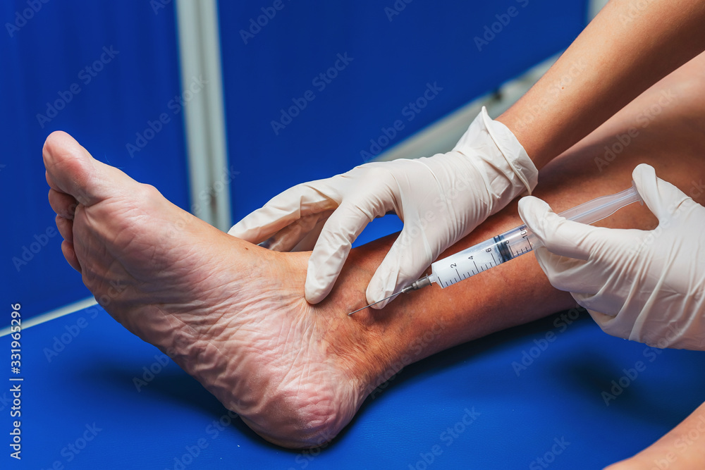 Injections into the veins of an elderly woman's leg close-up. Doctor's ...