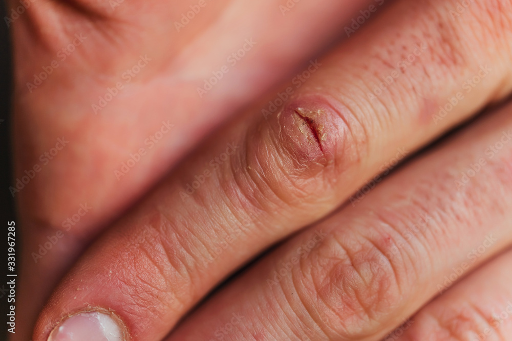 Men's fingers close up. Fingers without manicure groomed. Hands of hard ...