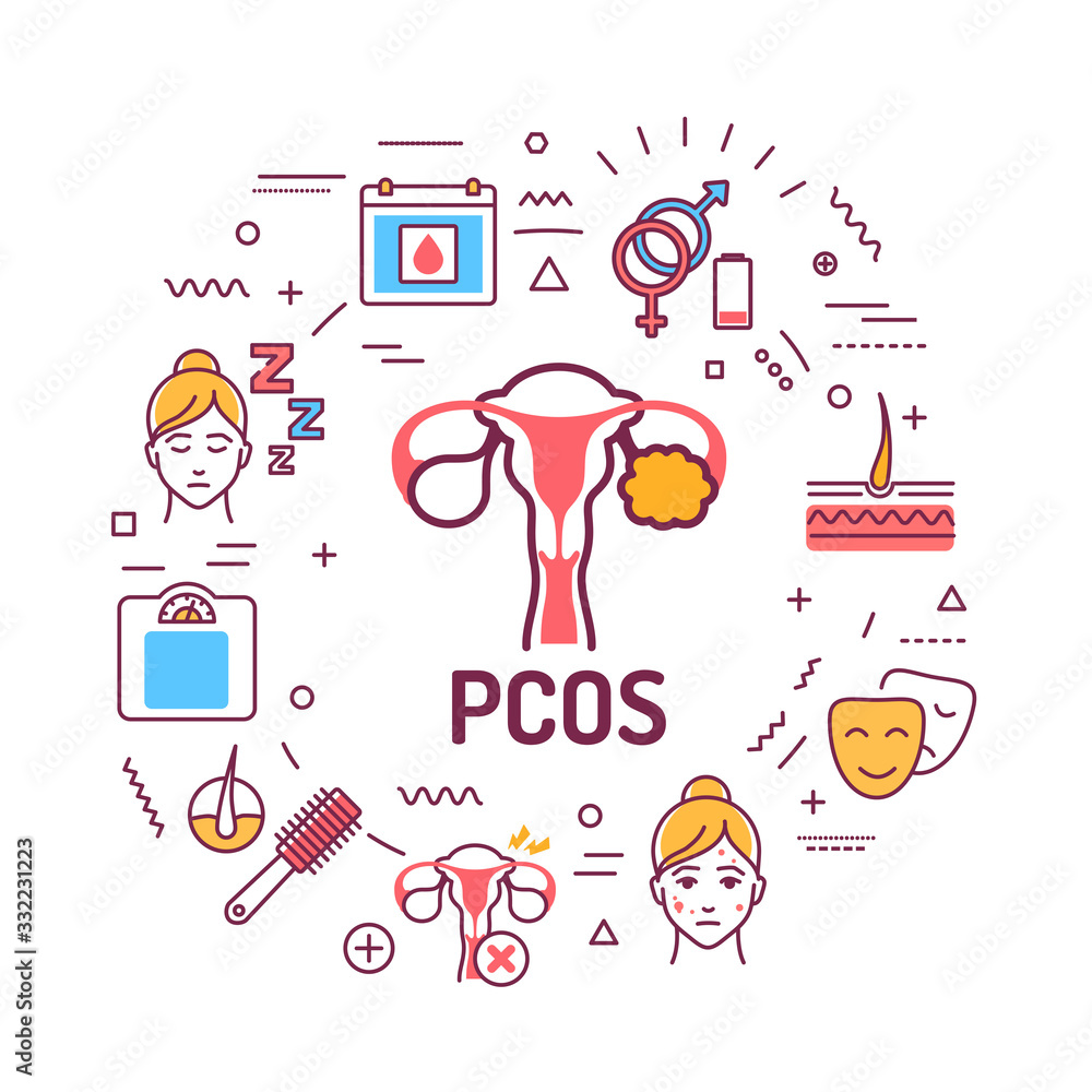 Pcos Symptoms Web Banner Female Reproductive System Disease