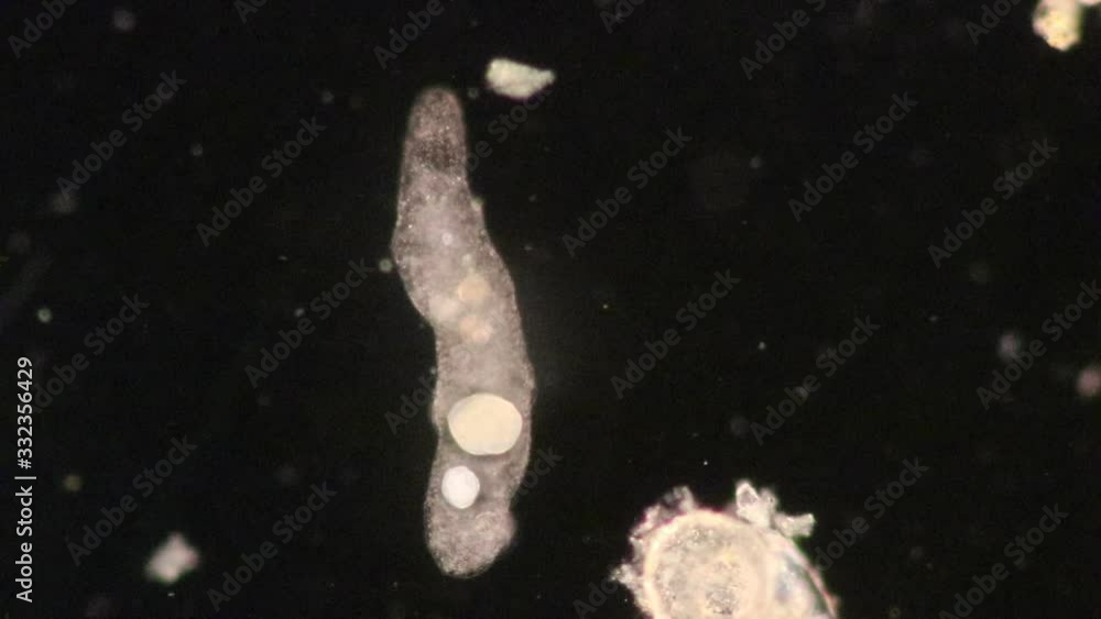 Amoebae move and feed by using pseudopods, which are bulges of ...