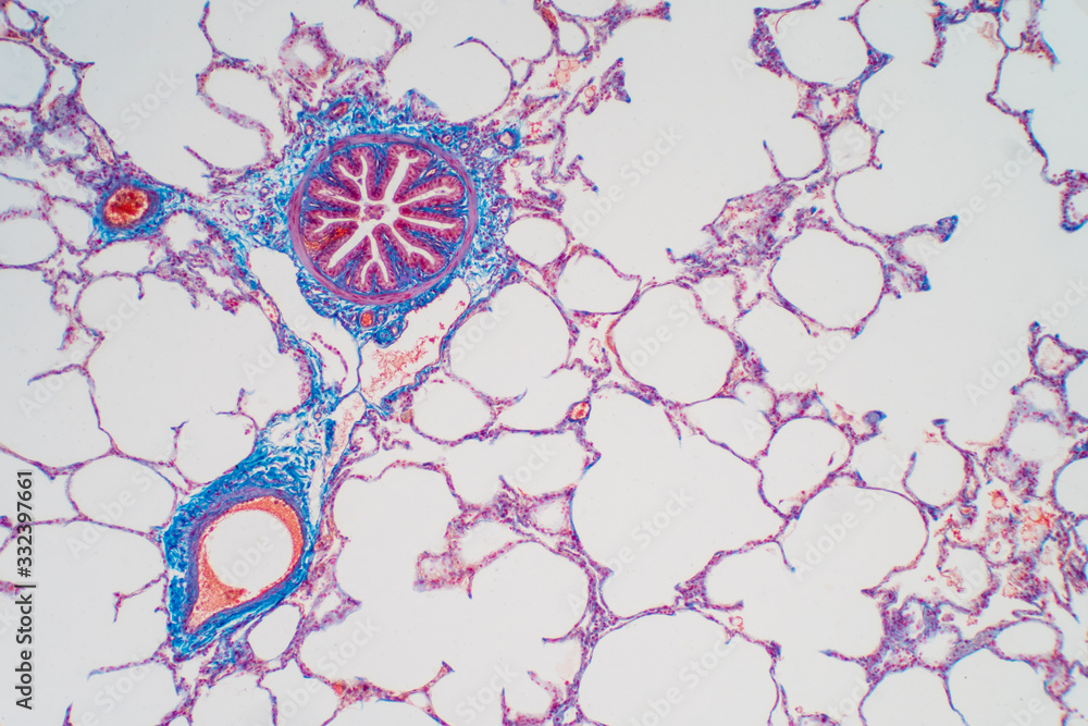 Human lung tissue under microscope, The lungs is organs of the ...