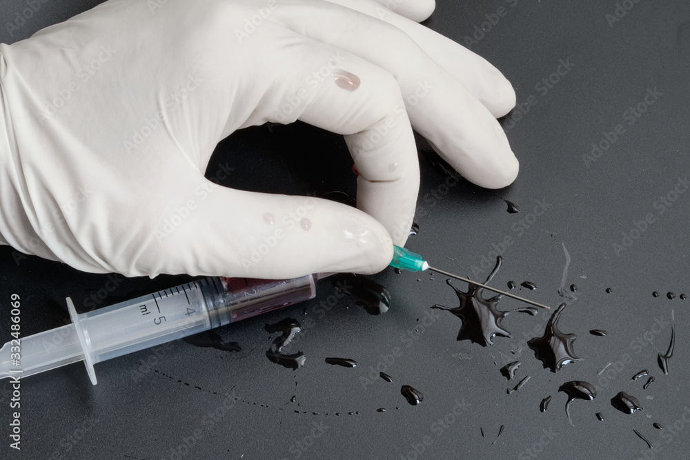 A small syringe into which a hollow, sharp-pointed bevel-cut needle is ...