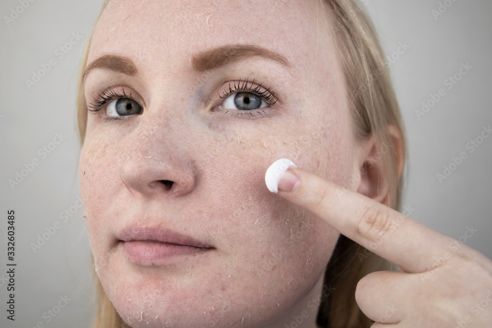 A woman examines dry skin on her face. Peeling, coarsening, discomfort ...