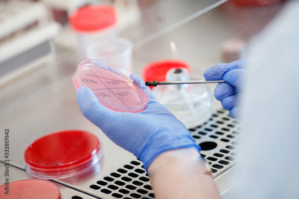 Microbiology hand medical working on agar plate culture bacteria and ...