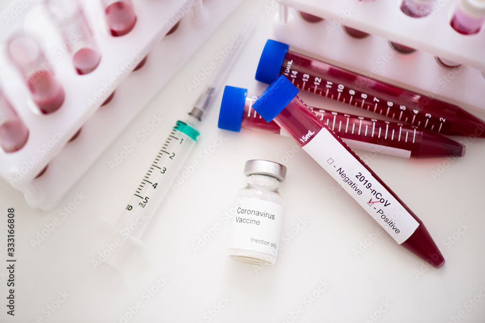 Test tube with blood sample for COVID-19 test, novel coronavirus 2019 ...