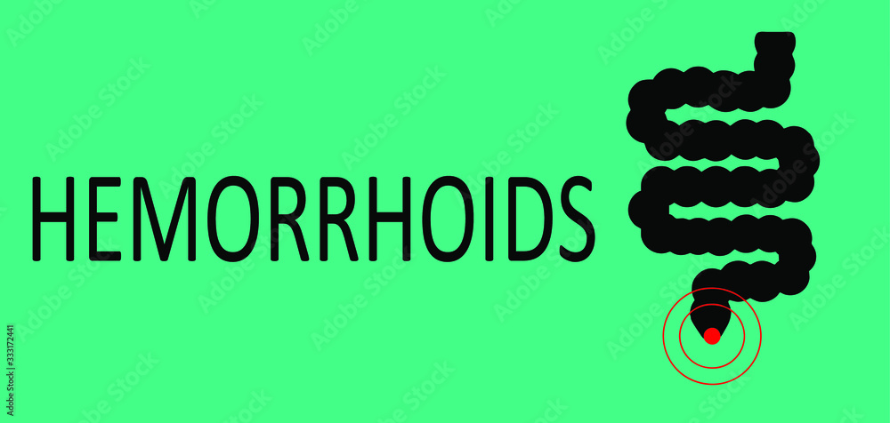 Hemorrhoids vector concept cartoon illustration with man Stock Vector ...