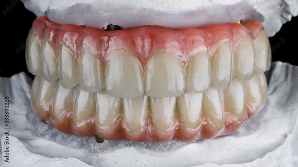 two dental prostheses made of ceramics with a pink gum made, on the ...