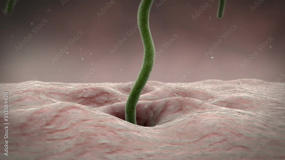Biomedical animation showing Helicobacter pylori bacteria entering ...