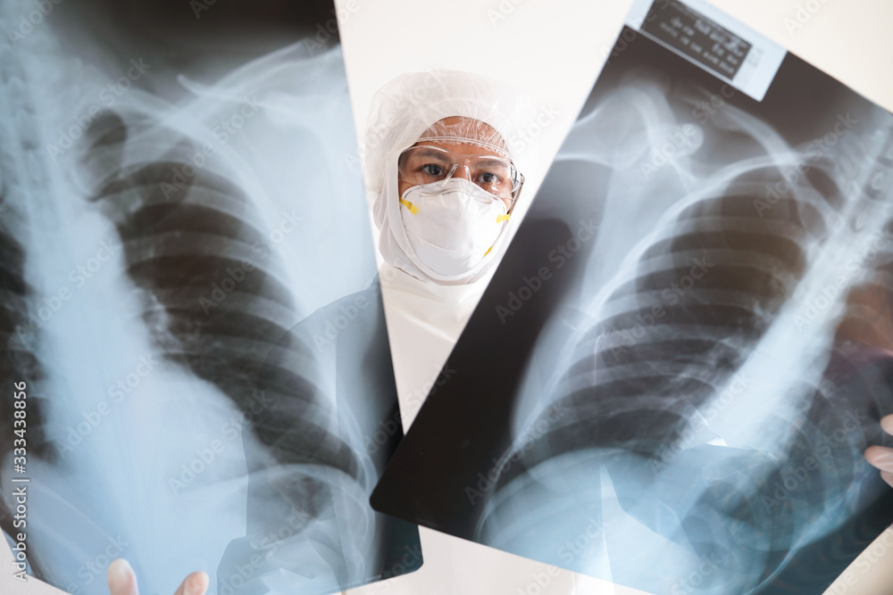 Doctor examining a lung radiography coronavirus covid 19 disease virus ...