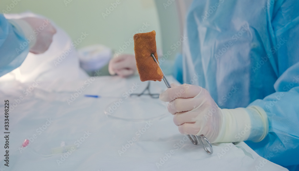 The actual operation to install a pacemaker, incision. Stock Photo ...