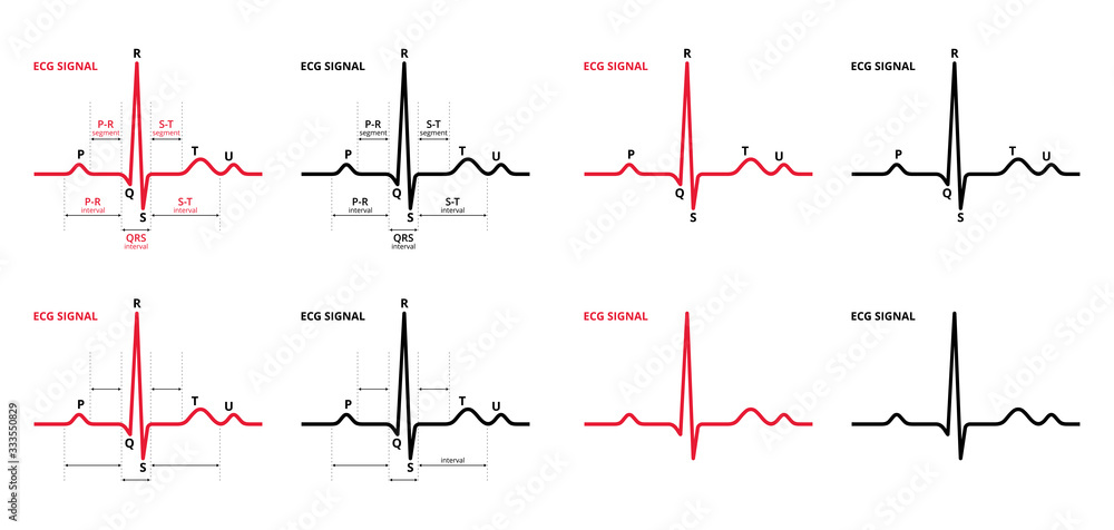 Sets of Electrocardiogram ECG or EKG heart beat graph signal pulse ...