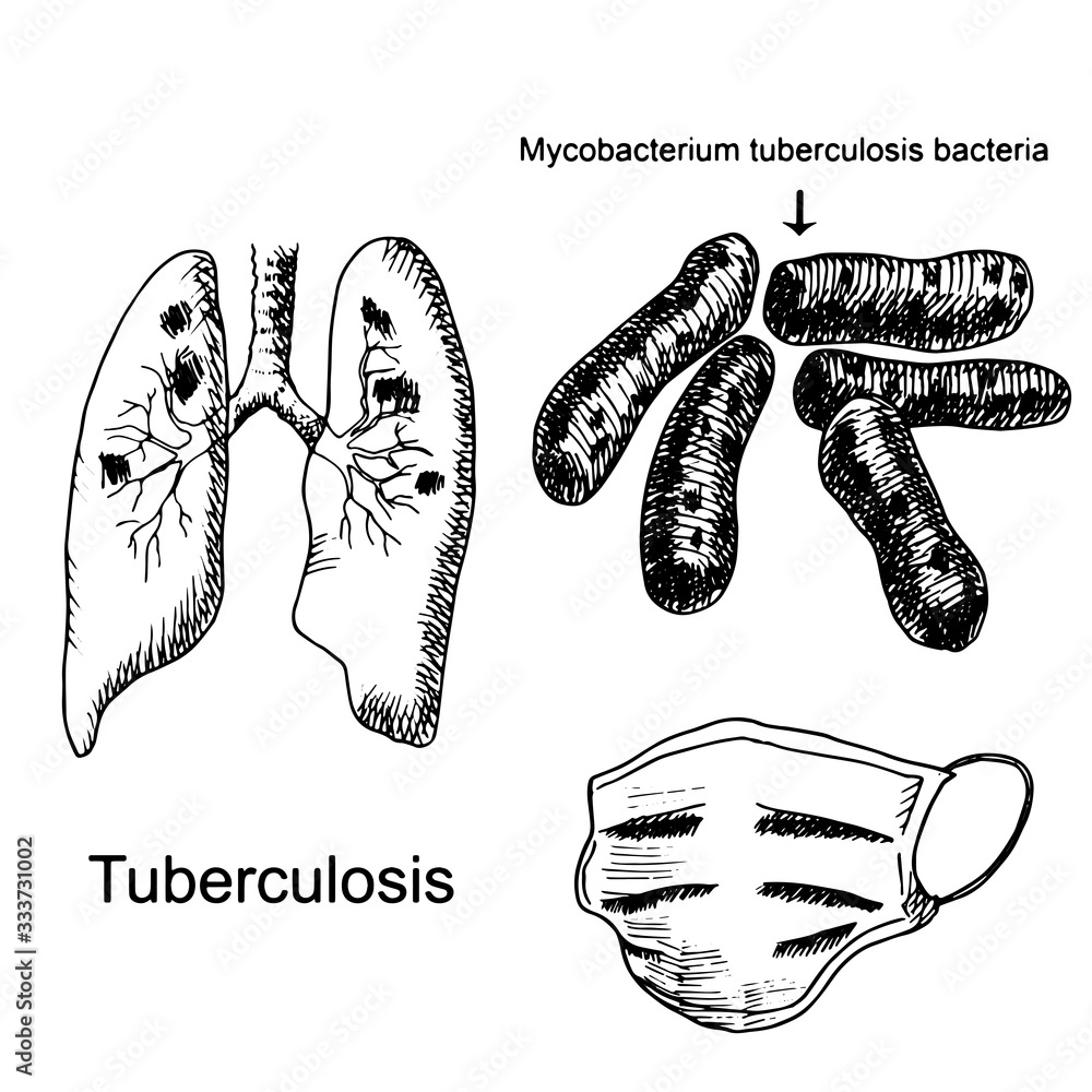Black and white vector illustration of Mycobacterium tuberculosis ...