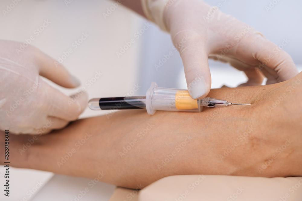 Laboratory assistant collecting blood sample from veins with vacuum ...