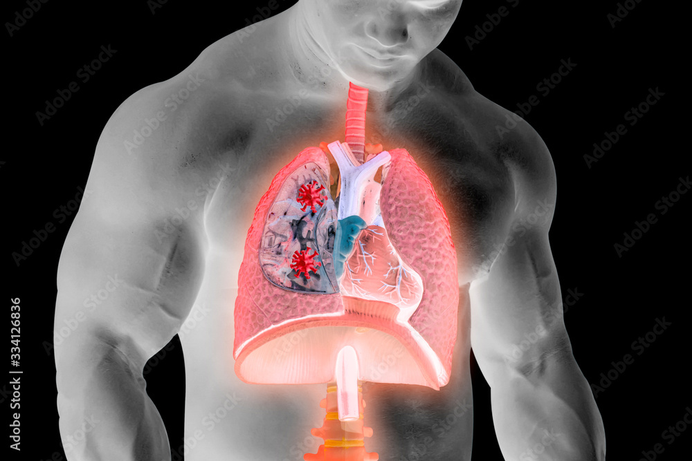 Chest x-ray of a patient showing Corona virus outbreak infecting ...