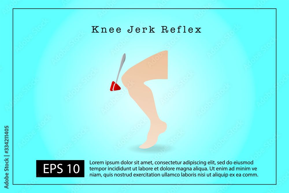 Knee Jerk Reflex vector, Medical Neurological examination Stock Vector ...
