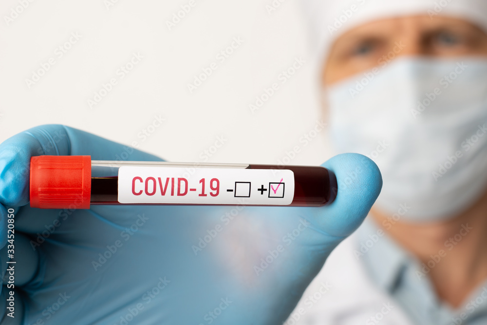 Frightened doctor holds Covid-19 blood test with positive result ...
