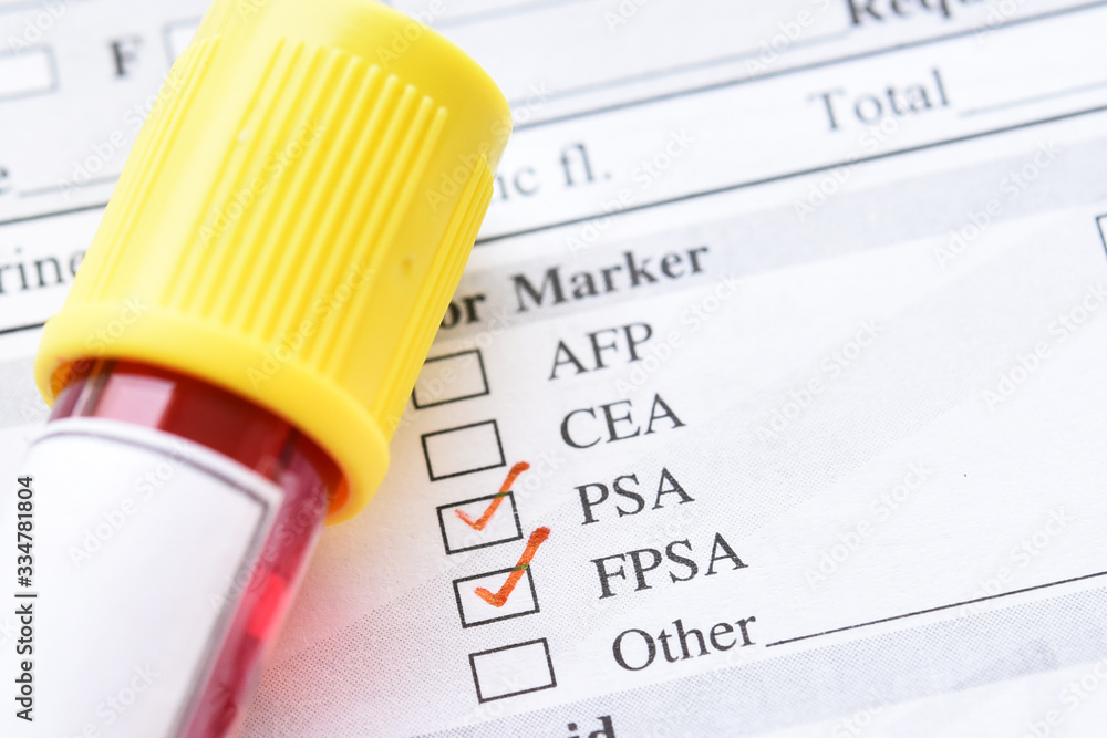 Blood sample tube with lab requisition form for PSA and free PSA test ...