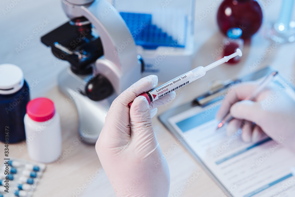 Nurse fills the form after coronavirus test. Analysis of test tube with ...