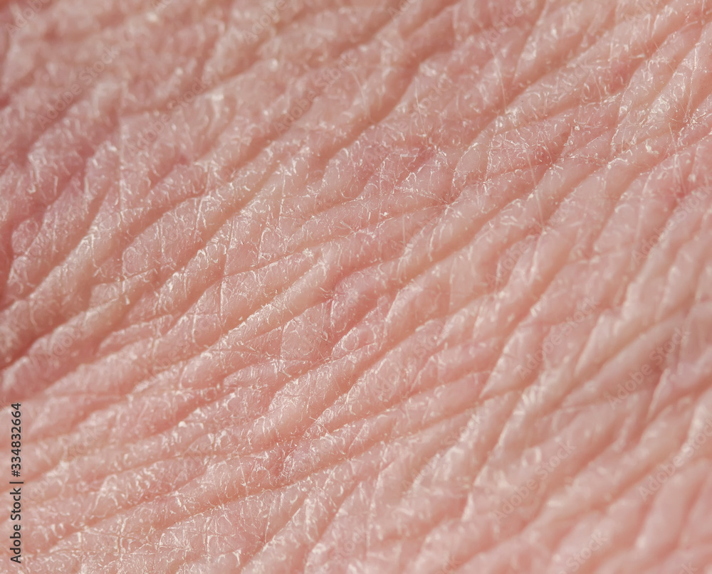 texture of pink unhealthy chapped human skin covered with deep wrinkles ...
