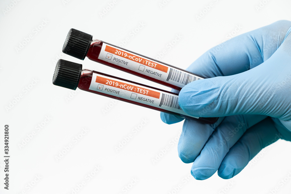Test tube with blood sample in lab for COVID-19 test in hand of doctor ...