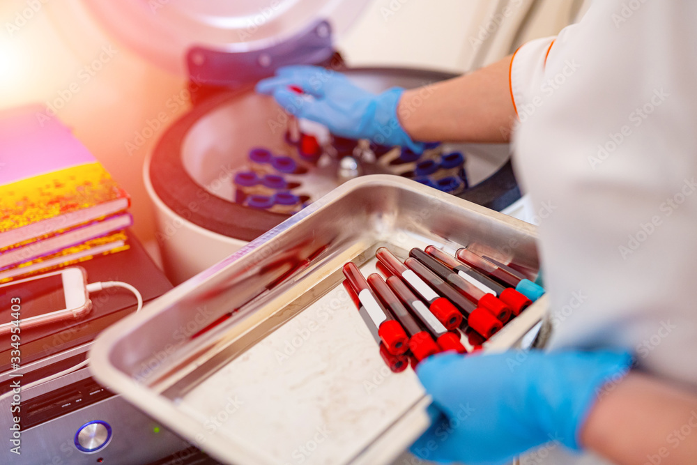 Testing in laboratory. Chemical research. Prevention. Pneumonia ...