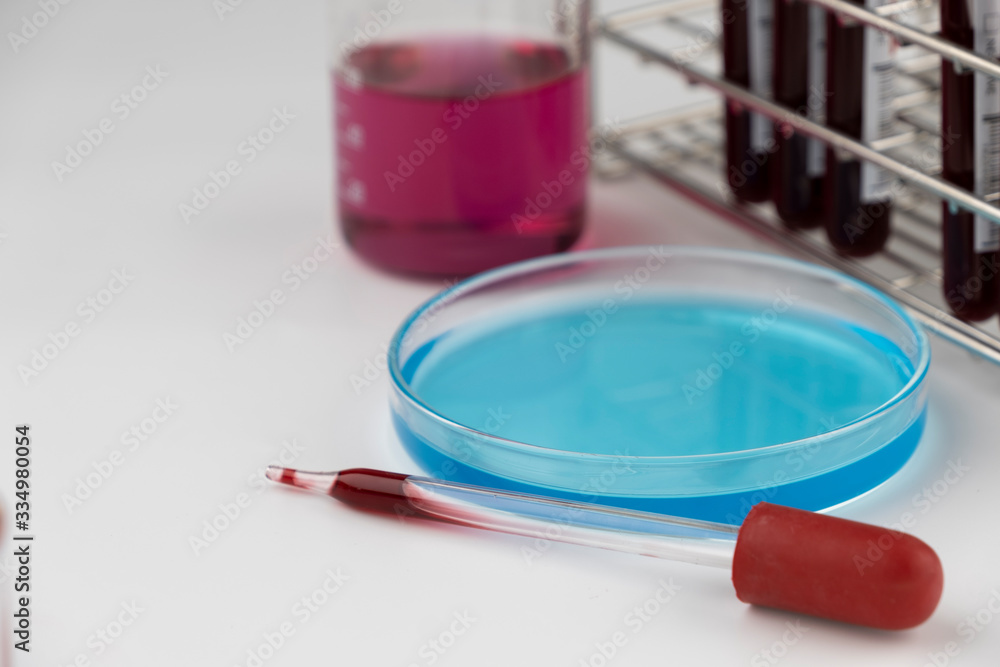 Methylene blue test liquid with blood sample for test, laboratory ...