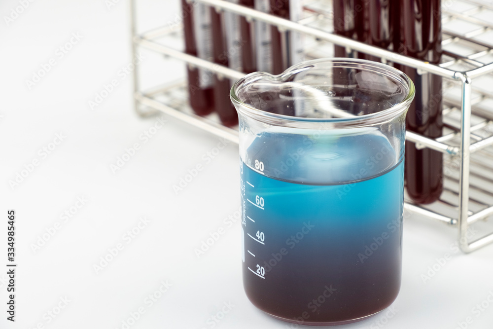 Methylene blue test liquid with blood sample for test, laboratory ...