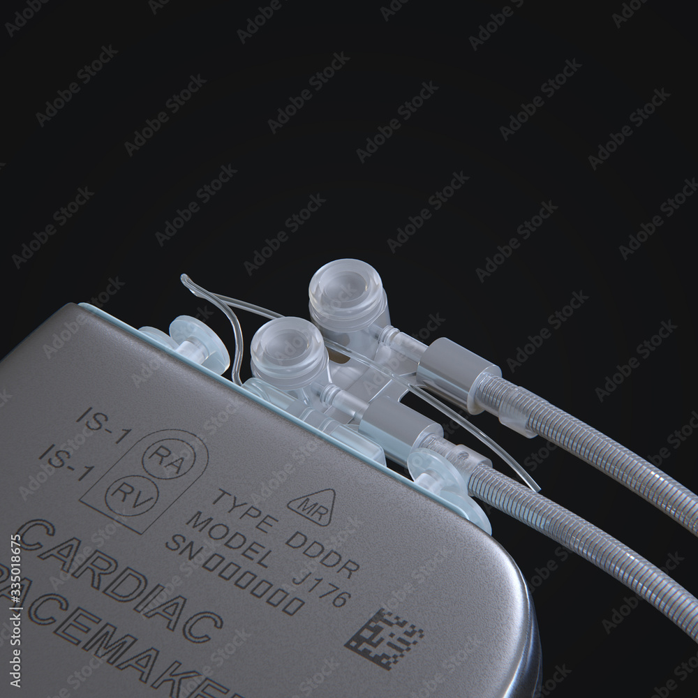 Cardiac Pacemaker Stock Photo | Adobe Stock