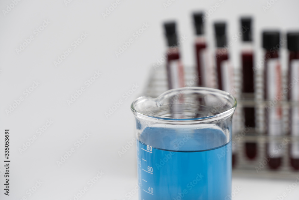 Methylene blue test liquid with blood sample for test, laboratory ...