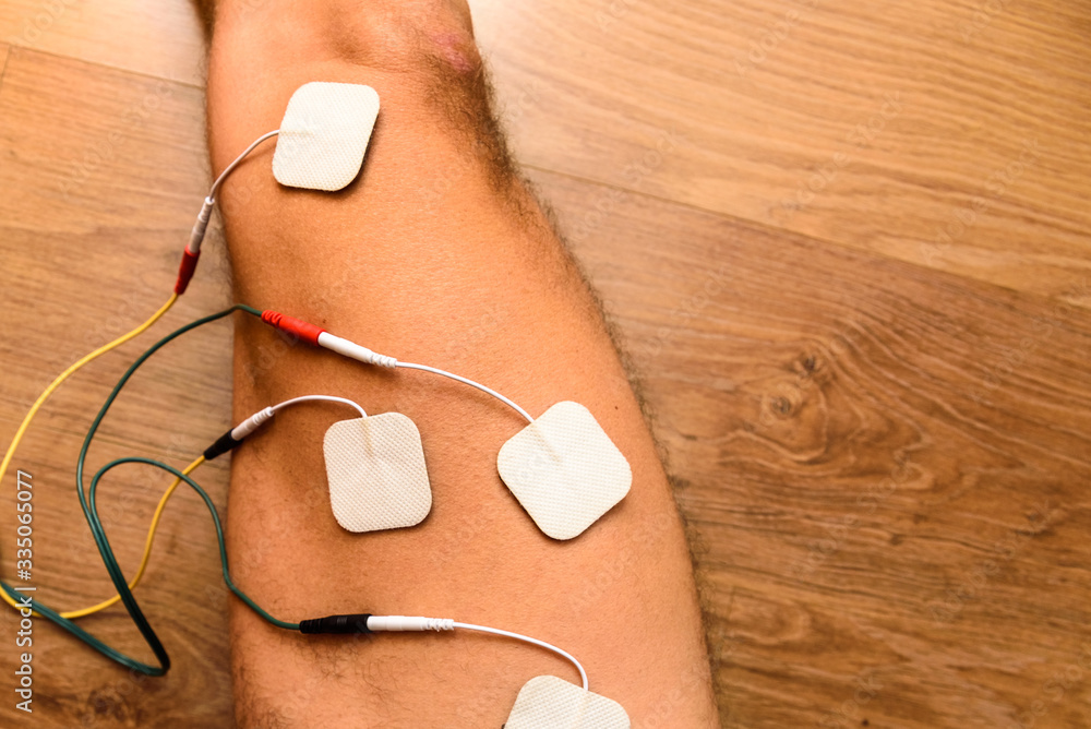 Electrodes of an electrostimulator on the leg of a male athlete. Stock ...